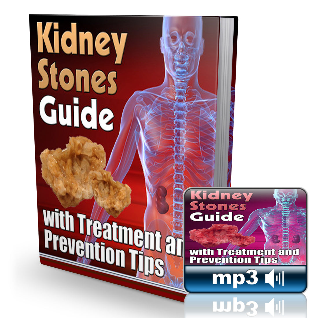 Natural Kidney Stones Guide Combo - Instant Downloadable Book (50+ pag ...